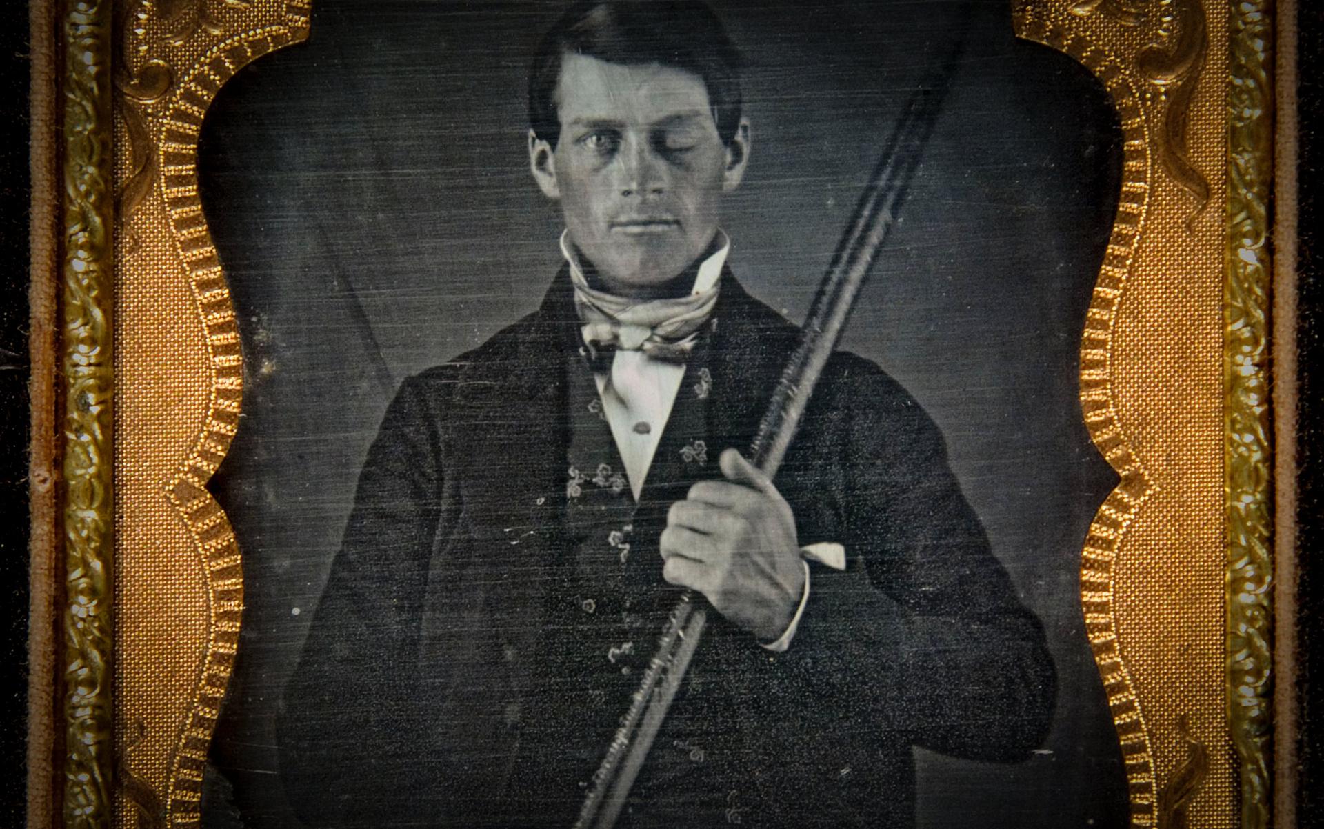 How the ‘myth of Phineas Gage’ affects brain injury survivors | Aeon Essays