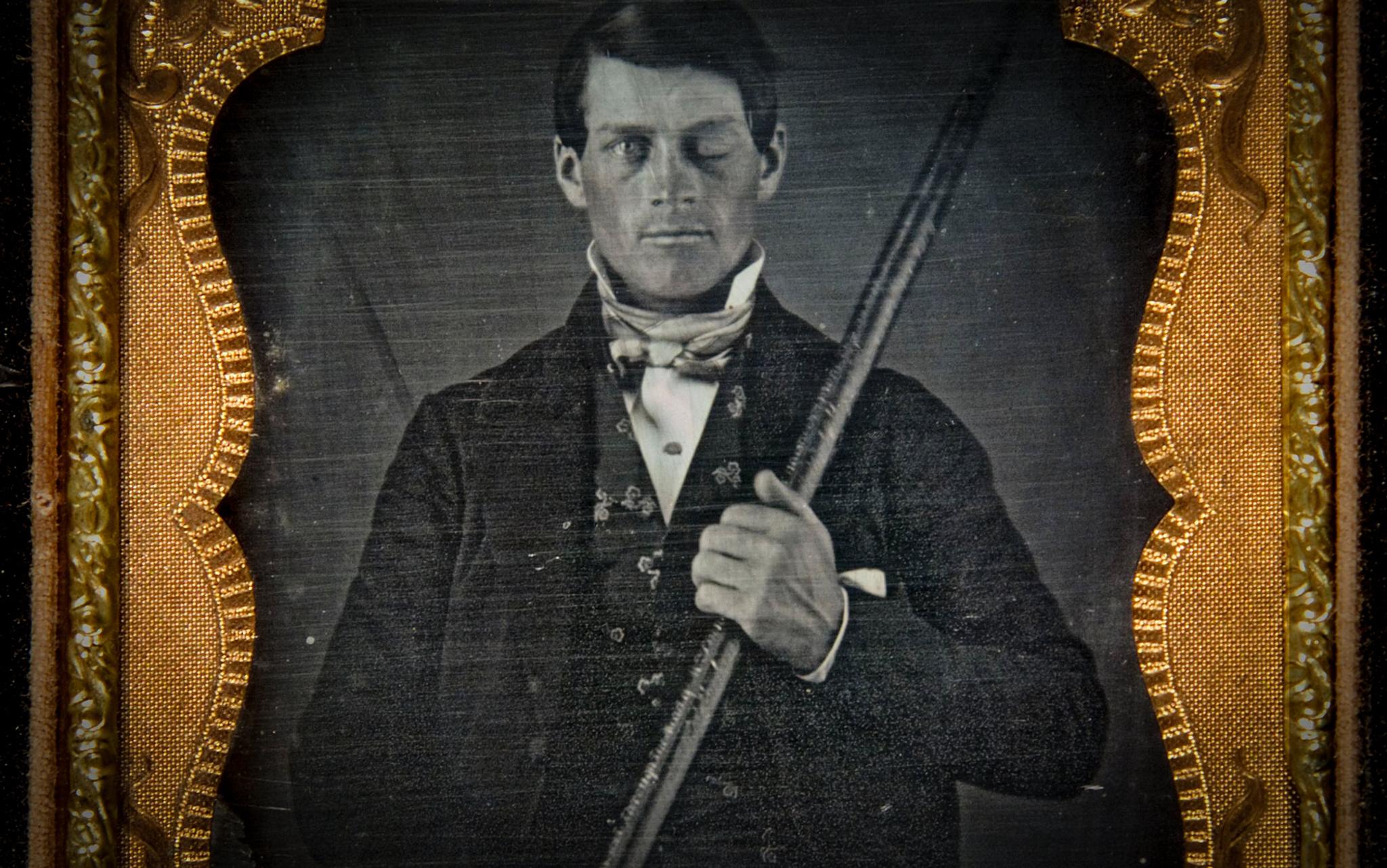 How the ‘myth of Phineas Gage’ affects brain injury survivors | Aeon Essays