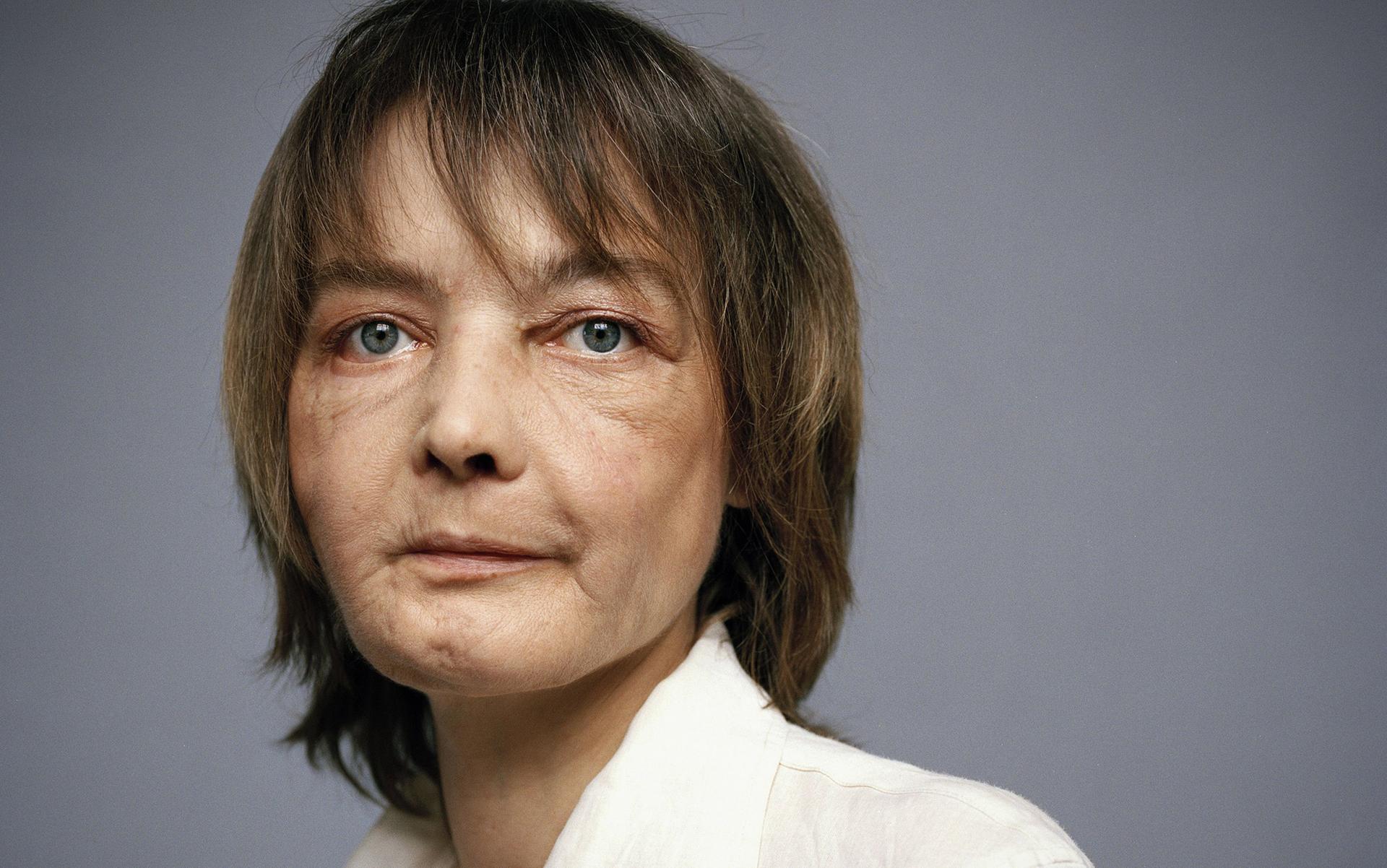 What do face transplants say about identity and wellbeing? | Aeon Essays