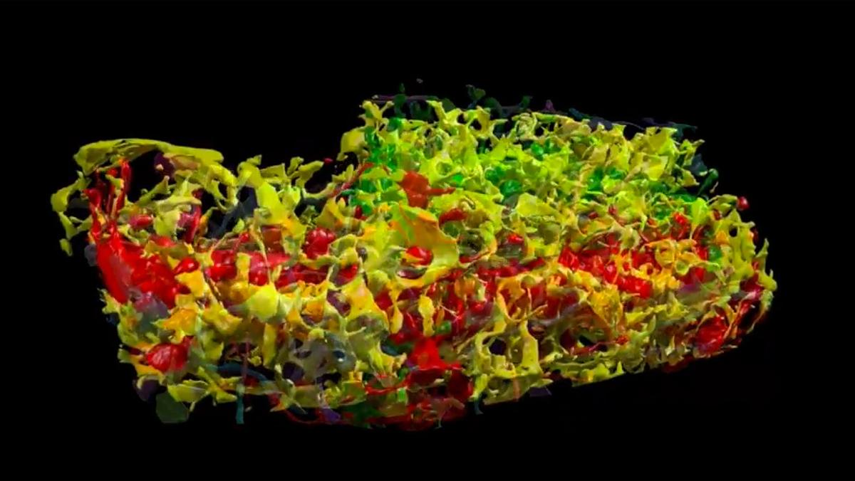 Can a tiny slice of mouse brain help us understand the complex human ...