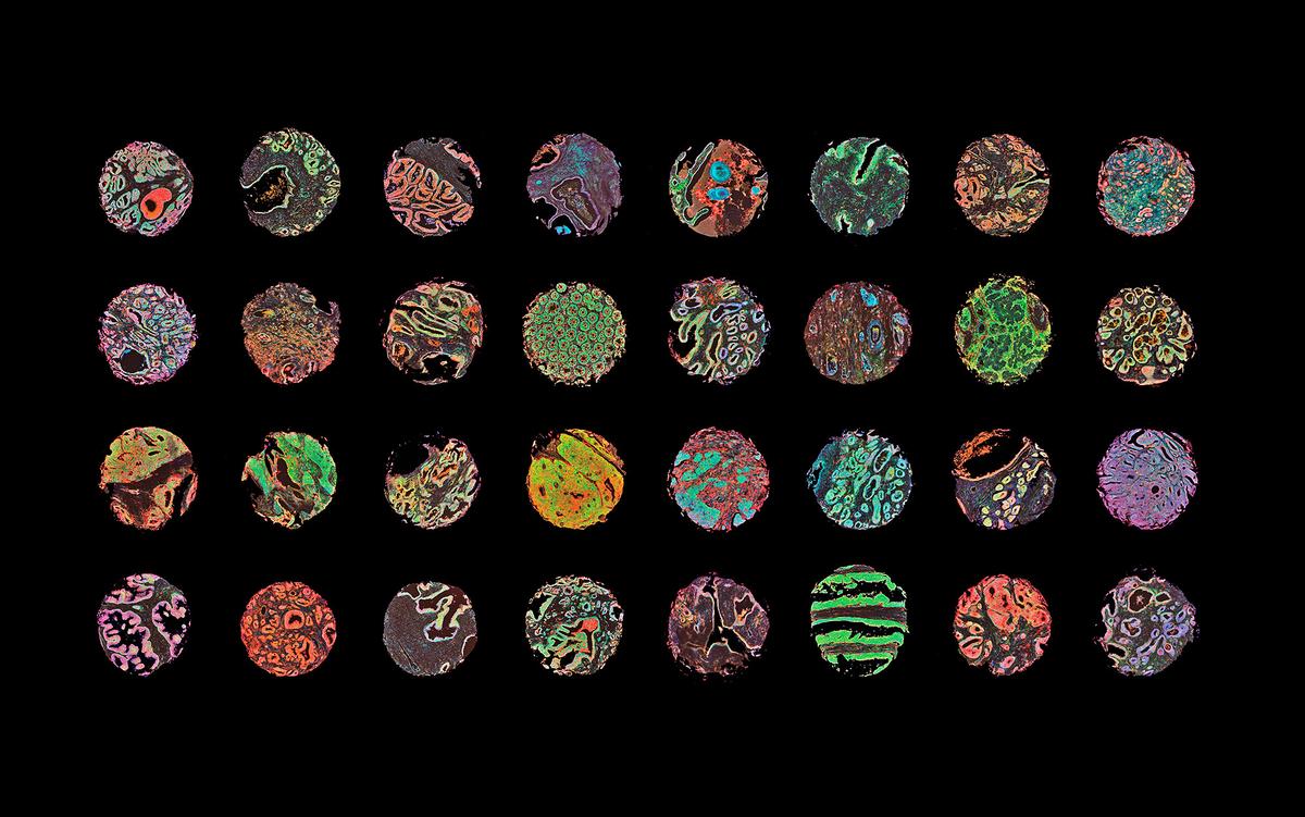 It’s time for science to abandon the term ‘statistically significant ...