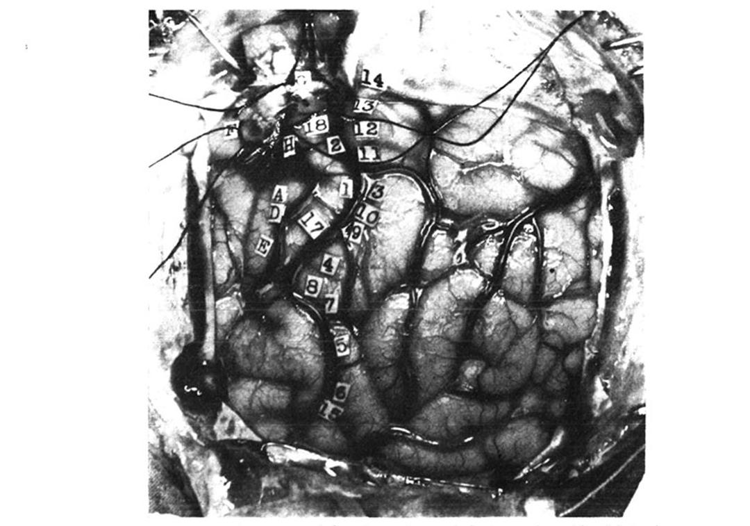 The iconic brain map that’s changing neurosurgery and gaming | Aeon Essays
